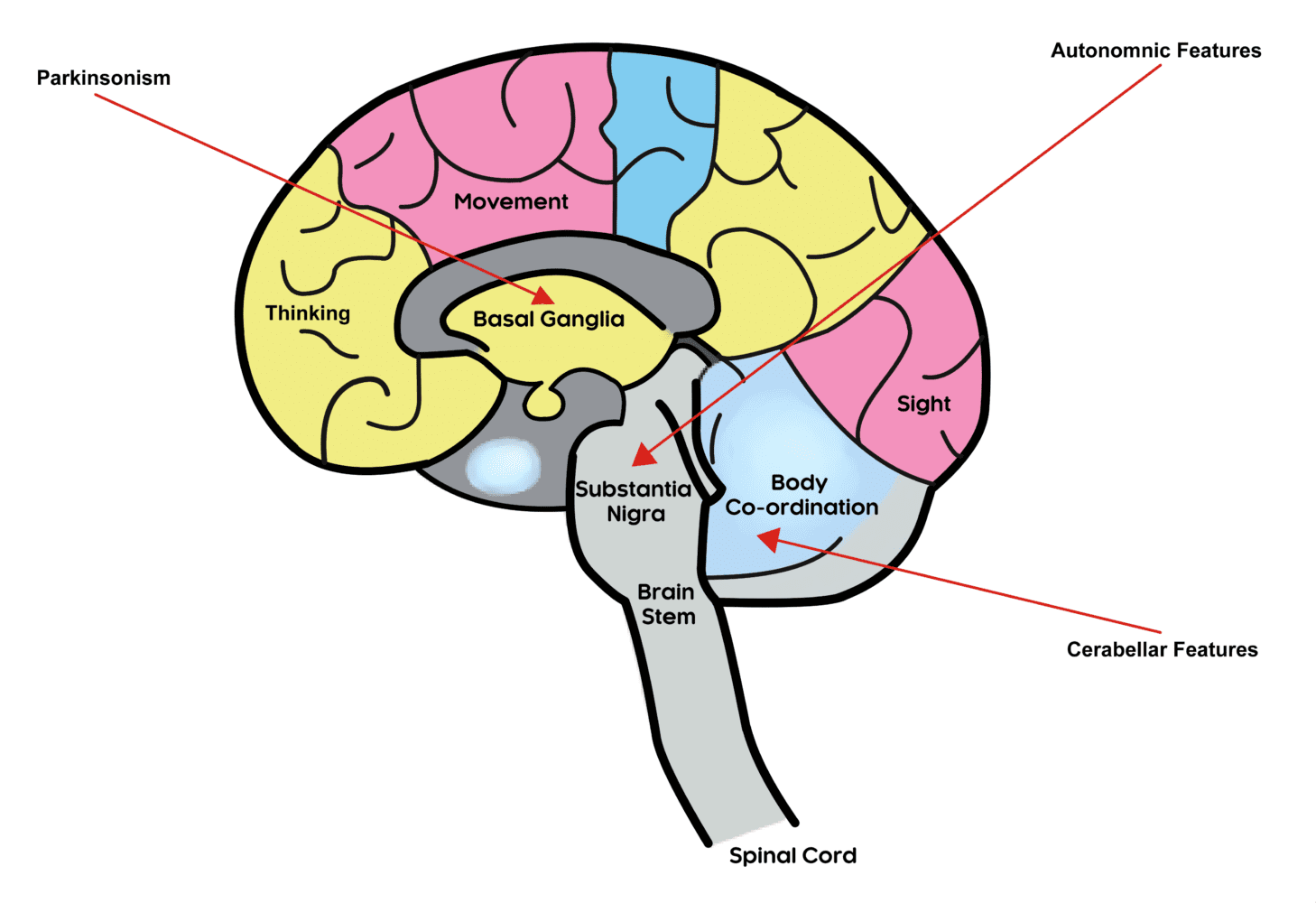 What are the symptoms of MSA? – Multiple System Atrophy Trust